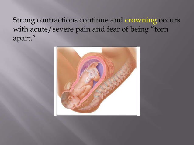 4 stages of labor and birth | PPTX