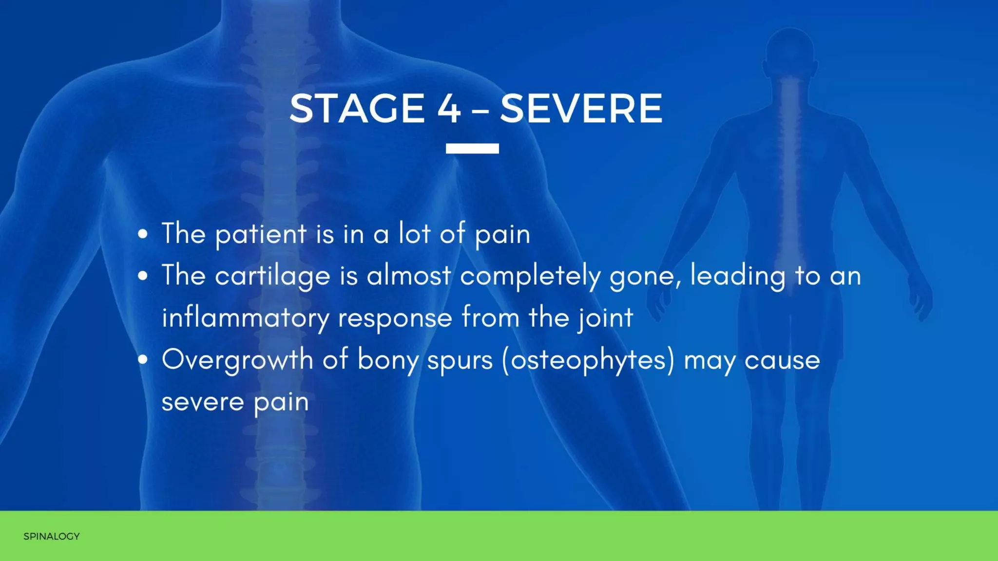 4 stages of osteoarthritis | PPTX