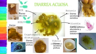 4 Sx diarreico y disentérico.pptx