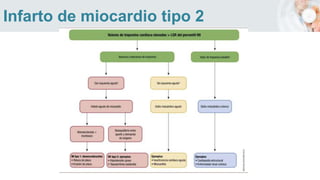 4TA DEFINICION UNIVERSAL DE INFARTO.pptx