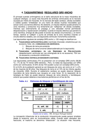 Taquiarritmias regulares QRS ancho | PDF