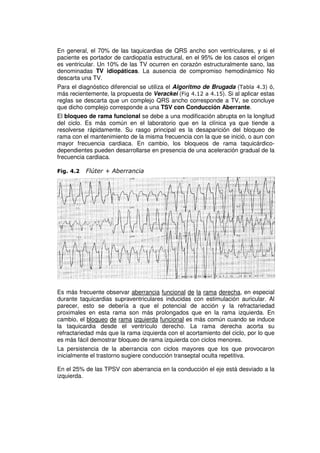 Taquiarritmias regulares QRS ancho | PDF