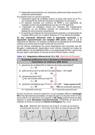 Taquiarritmias regulares QRS ancho | PDF