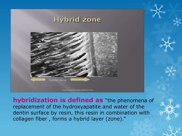 4th 5th 6th generation of bonding agents | PPTX | Dental Health ...