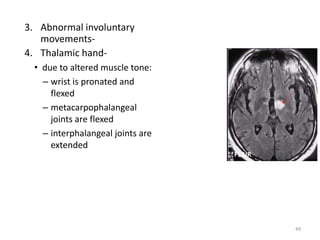 4 thalamus | PPT