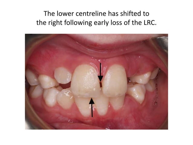 Ortho Photo Slides Test (4th BDS) | PPT