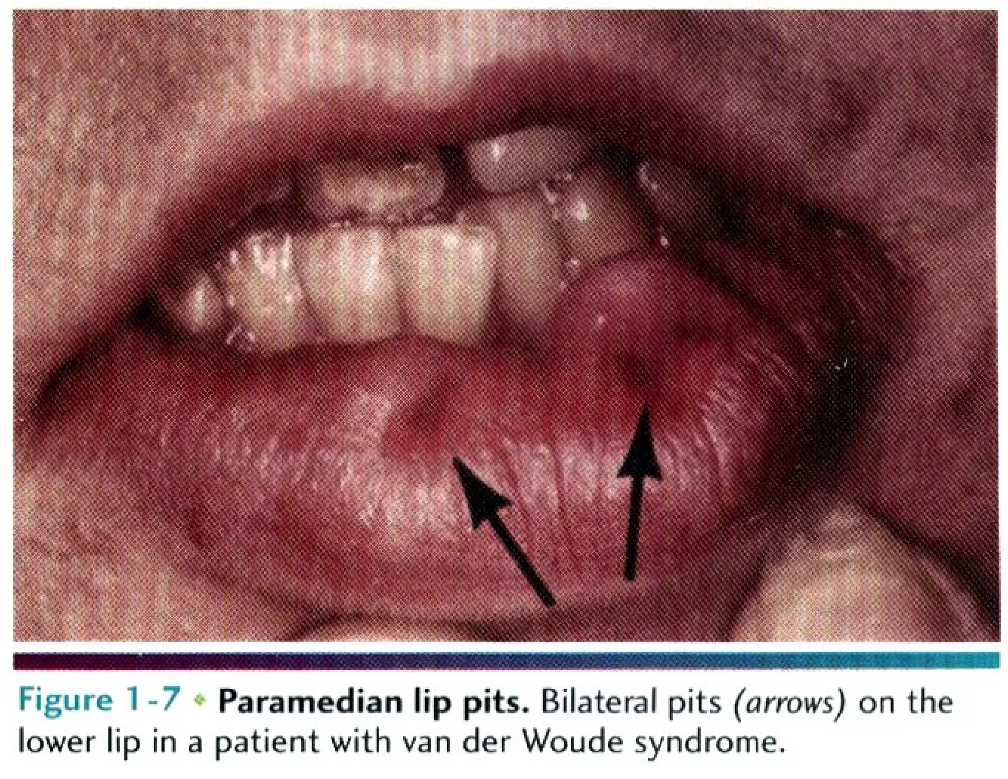 Oral Medicine Phone Slides (4th BDS) | PDF