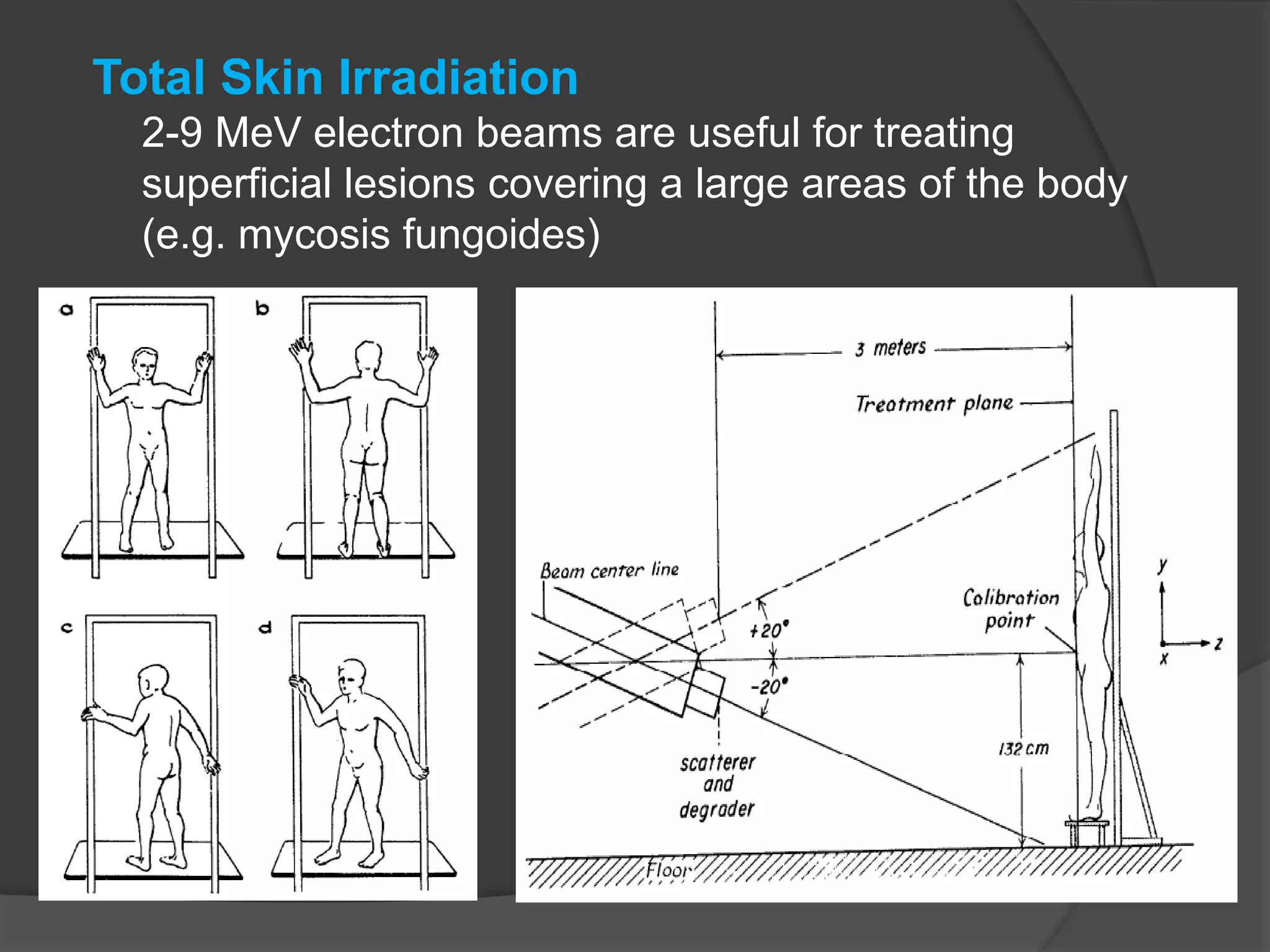 Electron Beam Therapy | PPT