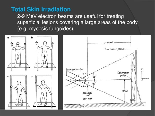 Electron Beam Therapy