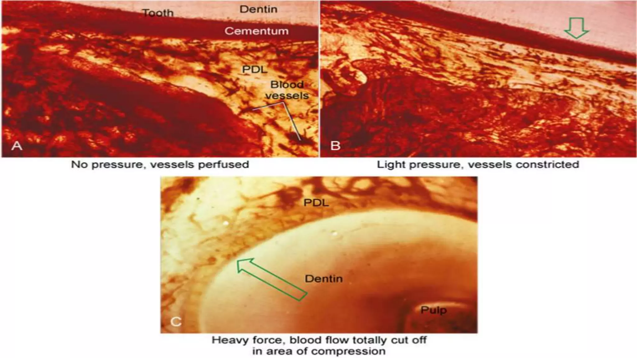 theories of tooth movement | PPTX