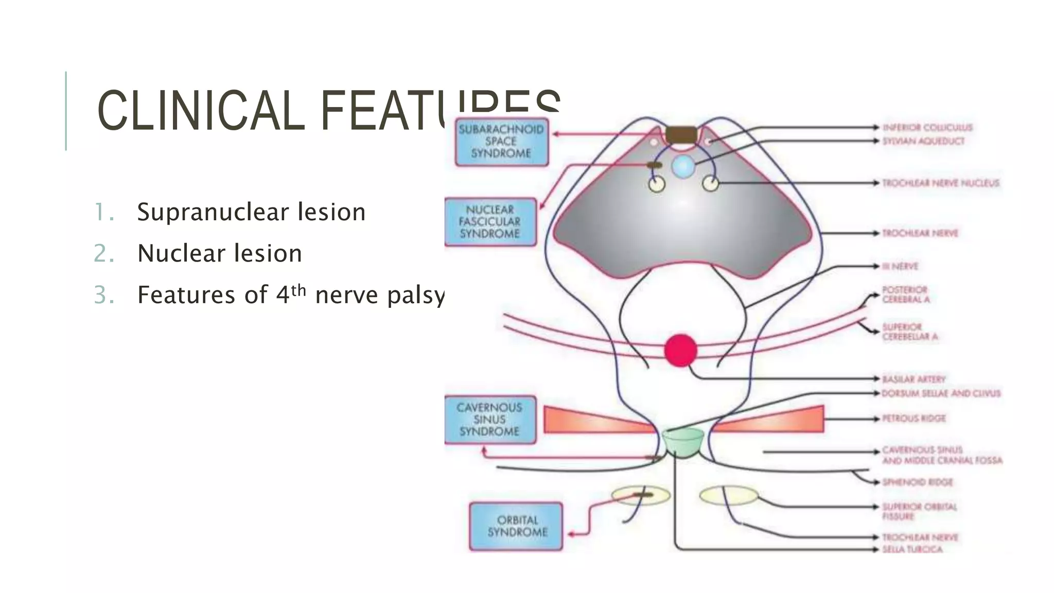 Trochlear nerve | PPTX