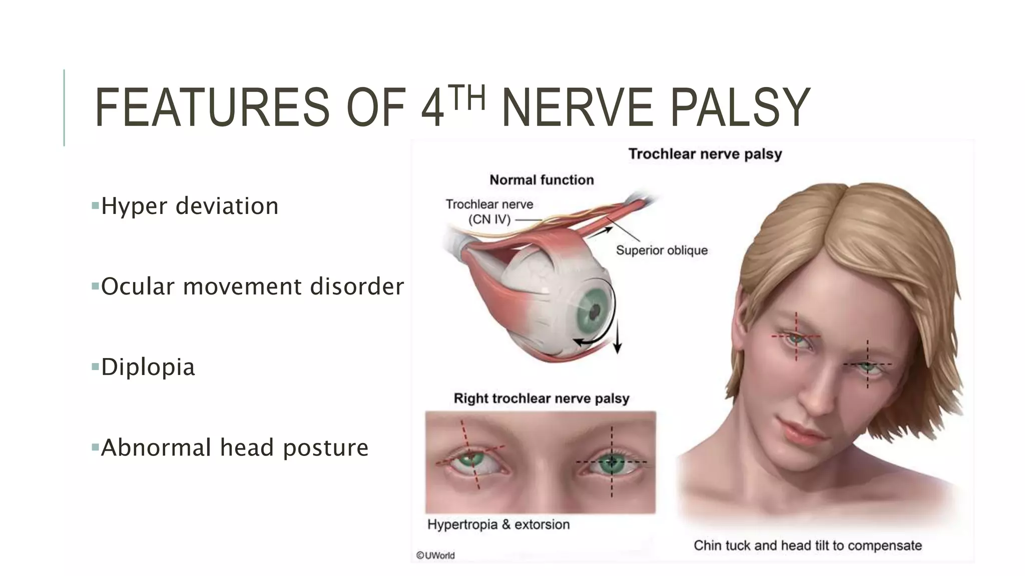 Trochlear nerve | PPTX