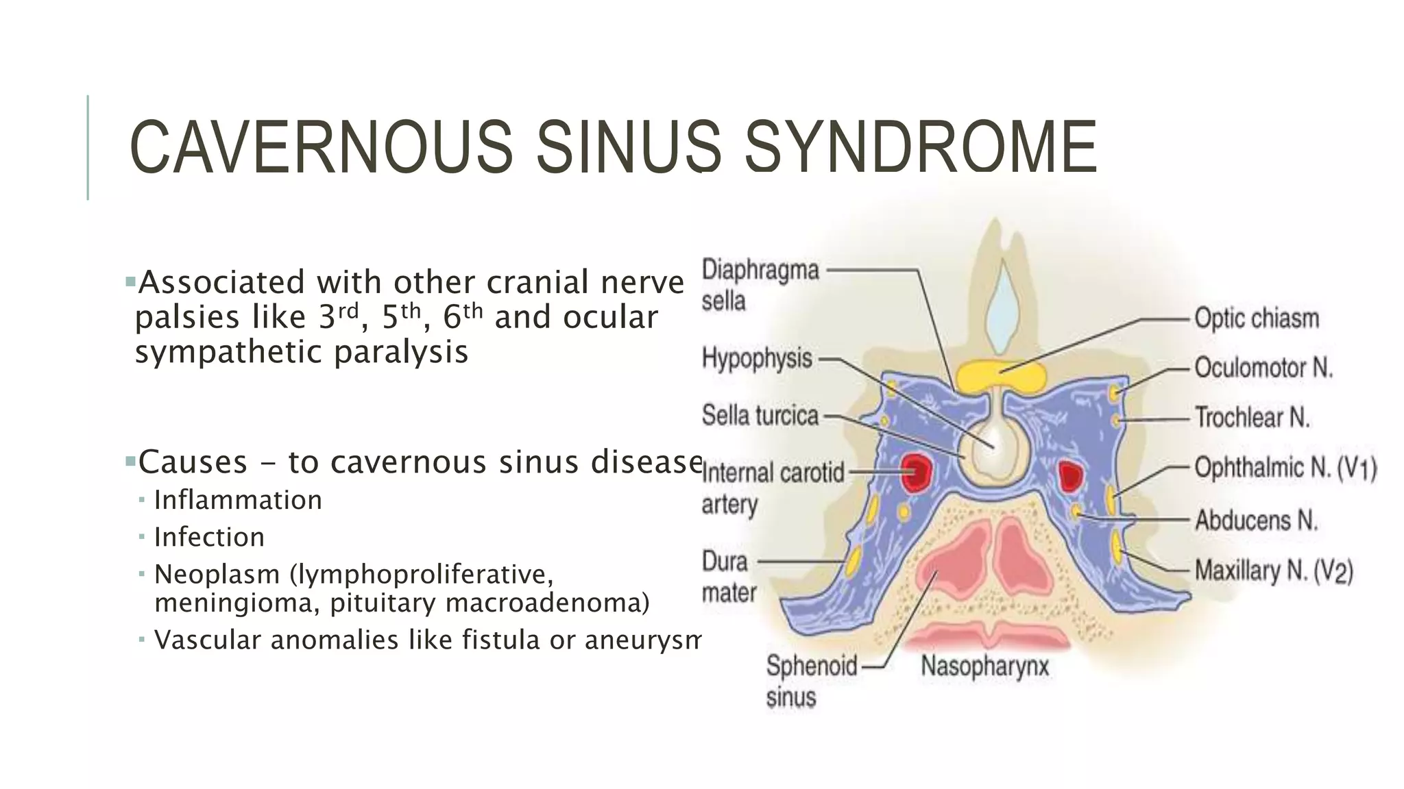 Trochlear nerve | PPTX