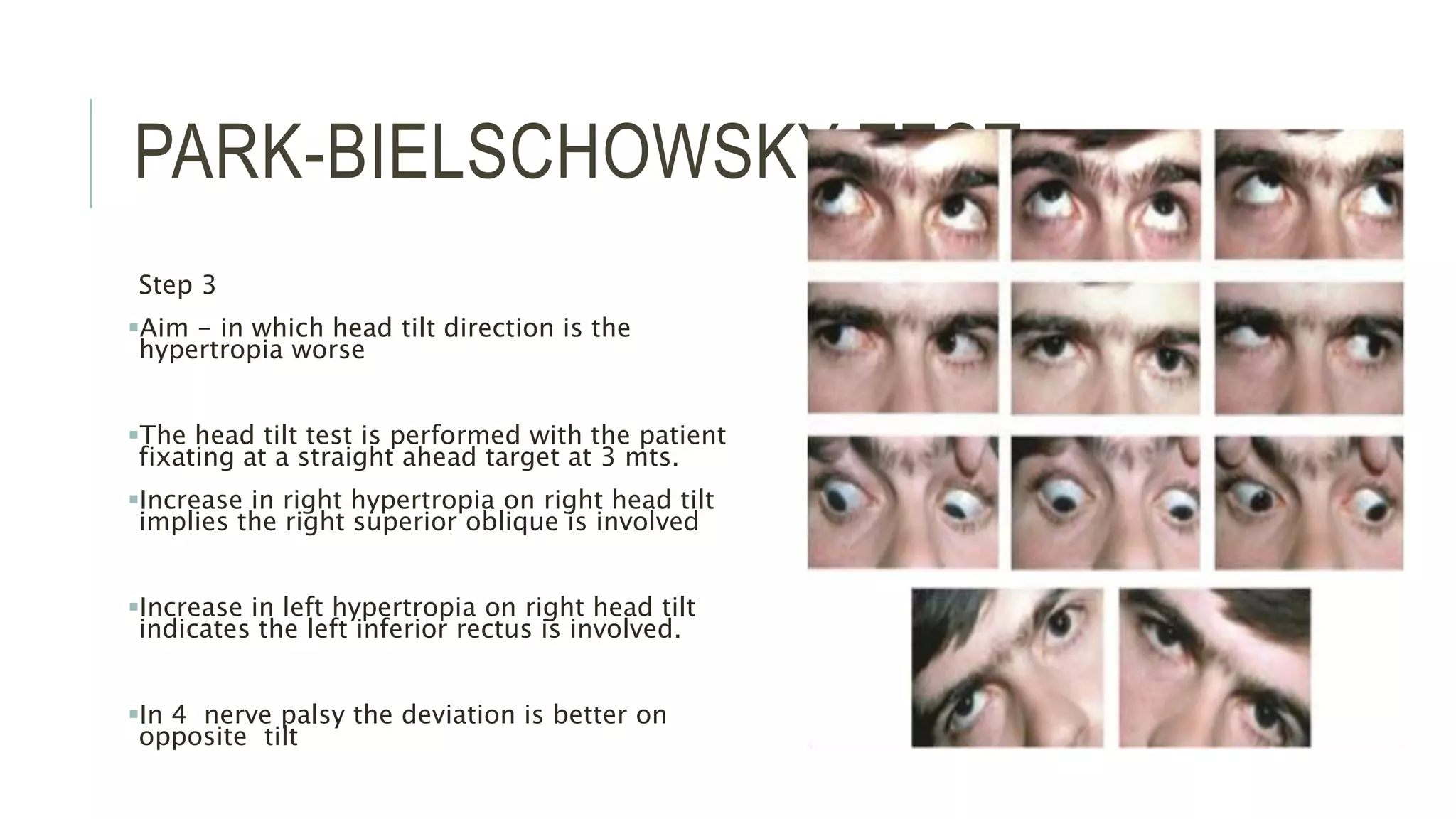 Trochlear nerve | PPTX