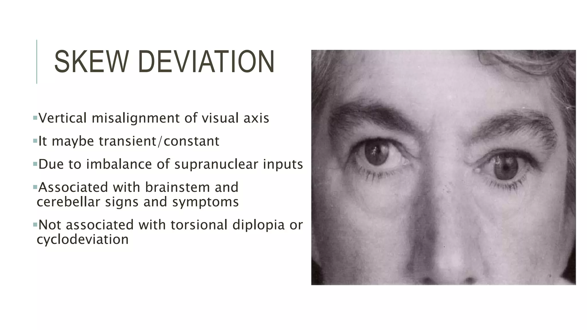 Trochlear nerve | PPTX