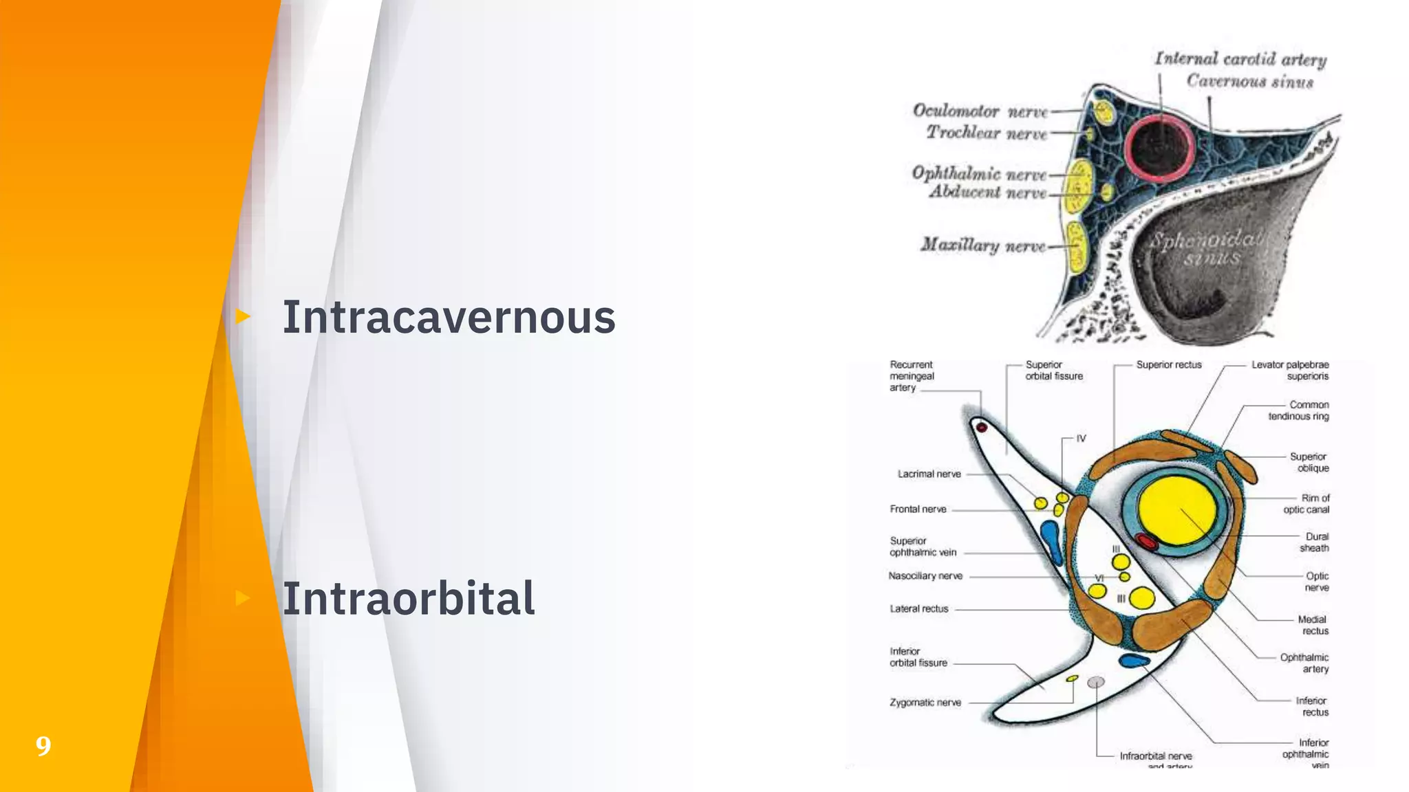 Trochlear nerve | PPTX