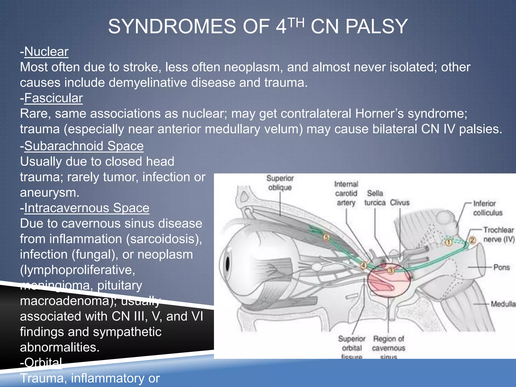 4th nerve palsy | PPTX