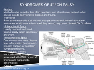 4th nerve palsy | PPTX