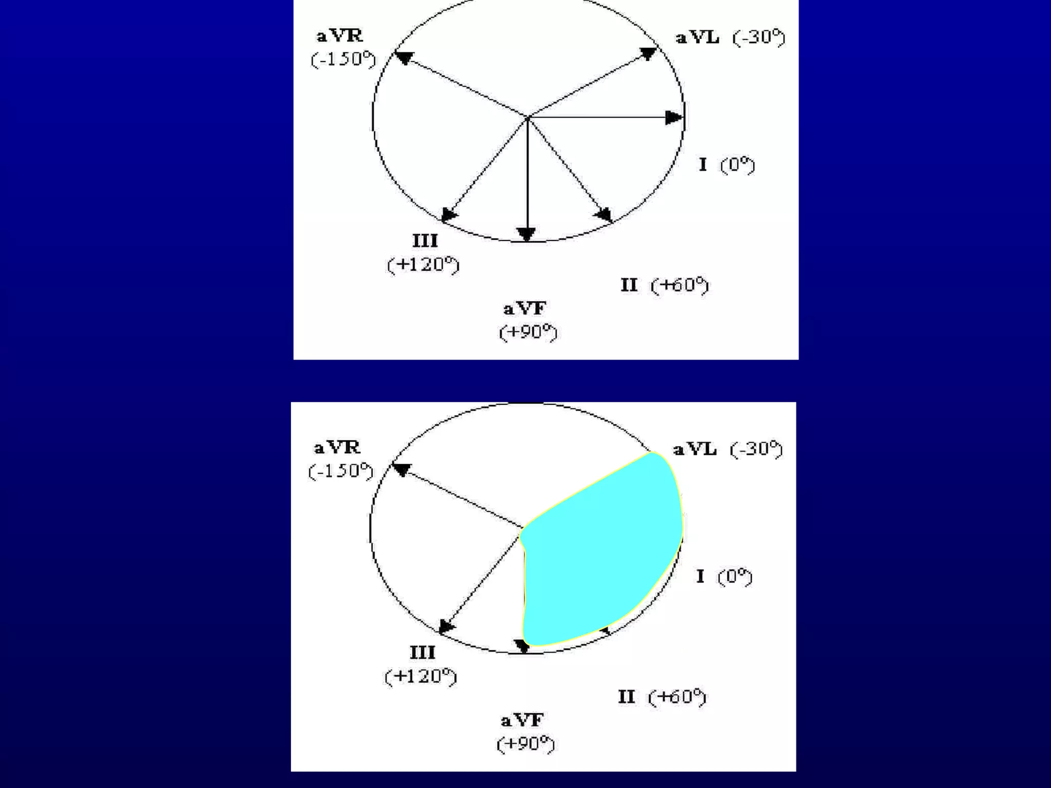 4th part ECG Basics: cardiac axis Dr Salah Mabrouk Khallaf | PPT