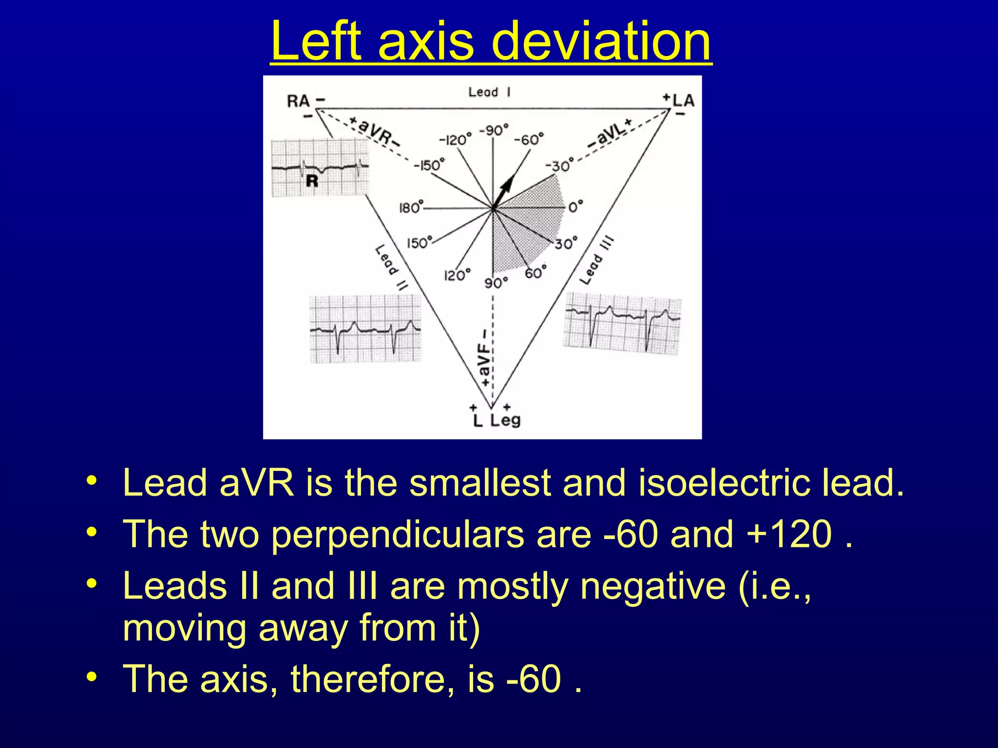 4th part ECG Basics: cardiac axis Dr Salah Mabrouk Khallaf | PPT