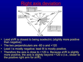 4th part ECG Basics: cardiac axis Dr Salah Mabrouk Khallaf | PPT