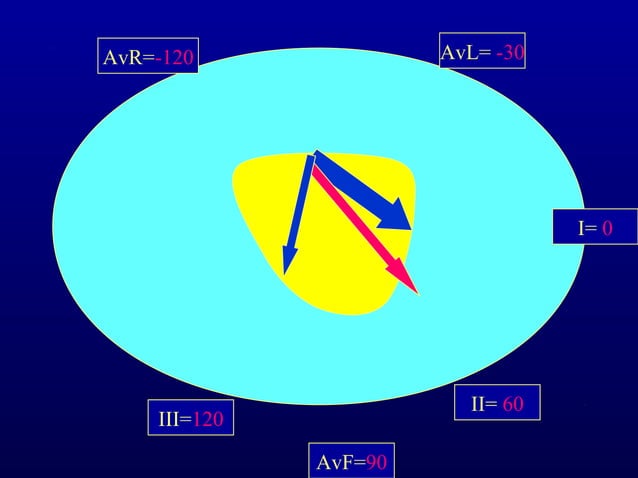 4th part ECG Basics: cardiac axis Dr Salah Mabrouk Khallaf | PPT ...