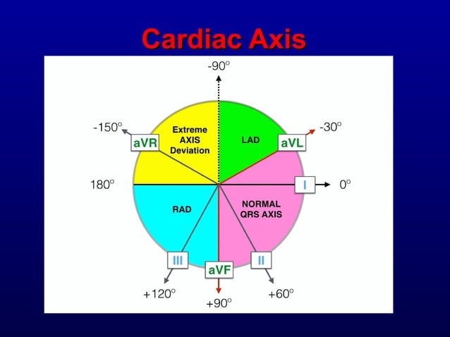 4th part ECG Basics: cardiac axis Dr Salah Mabrouk Khallaf | PPT ...