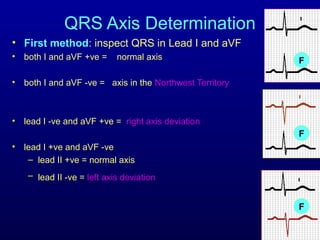 4th part ECG Basics: cardiac axis Dr Salah Mabrouk Khallaf | PPT