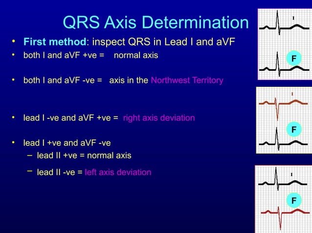 4th part ECG Basics: cardiac axis Dr Salah Mabrouk Khallaf | PPT ...
