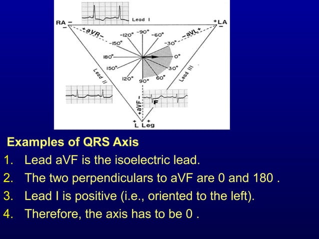 4th part ECG Basics: cardiac axis Dr Salah Mabrouk Khallaf | PPT ...