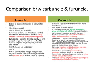Furuncle Vs Carbuncle