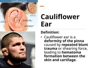 Nursing Management of Patients with Disorders of Ear, Nose, and Throat ...