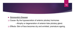 Pituitary Gland | PPT