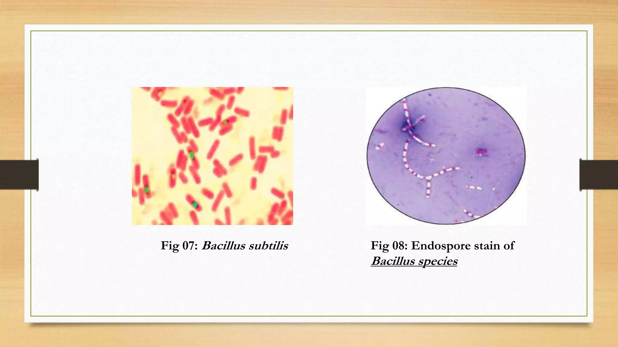Gram staining & structural Staining | PPTX
