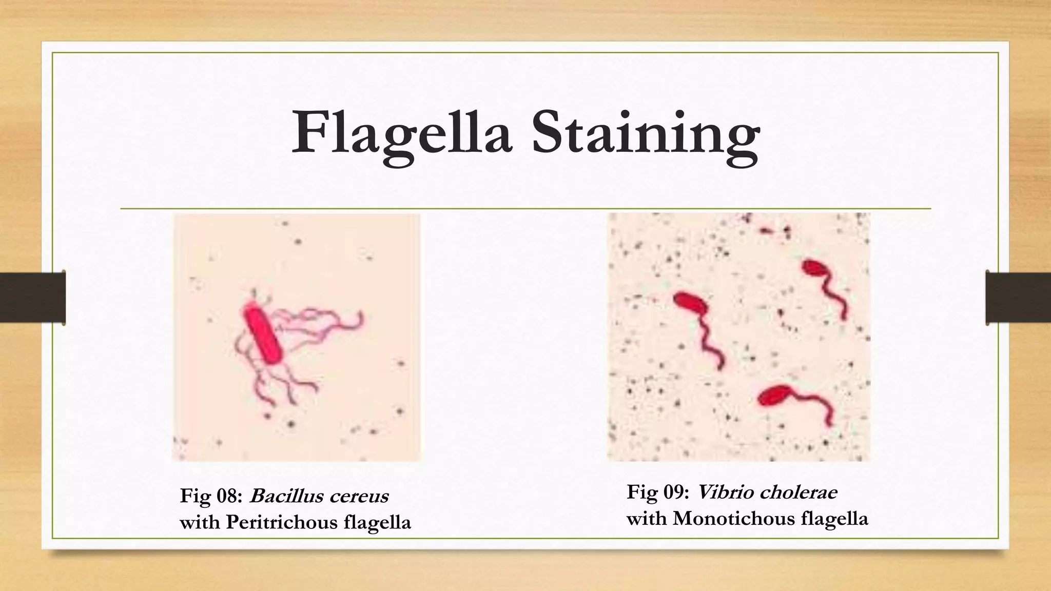 Gram staining & structural Staining | PPTX