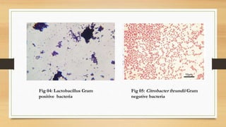 Gram staining & structural Staining | PPTX | Chemistry | Science