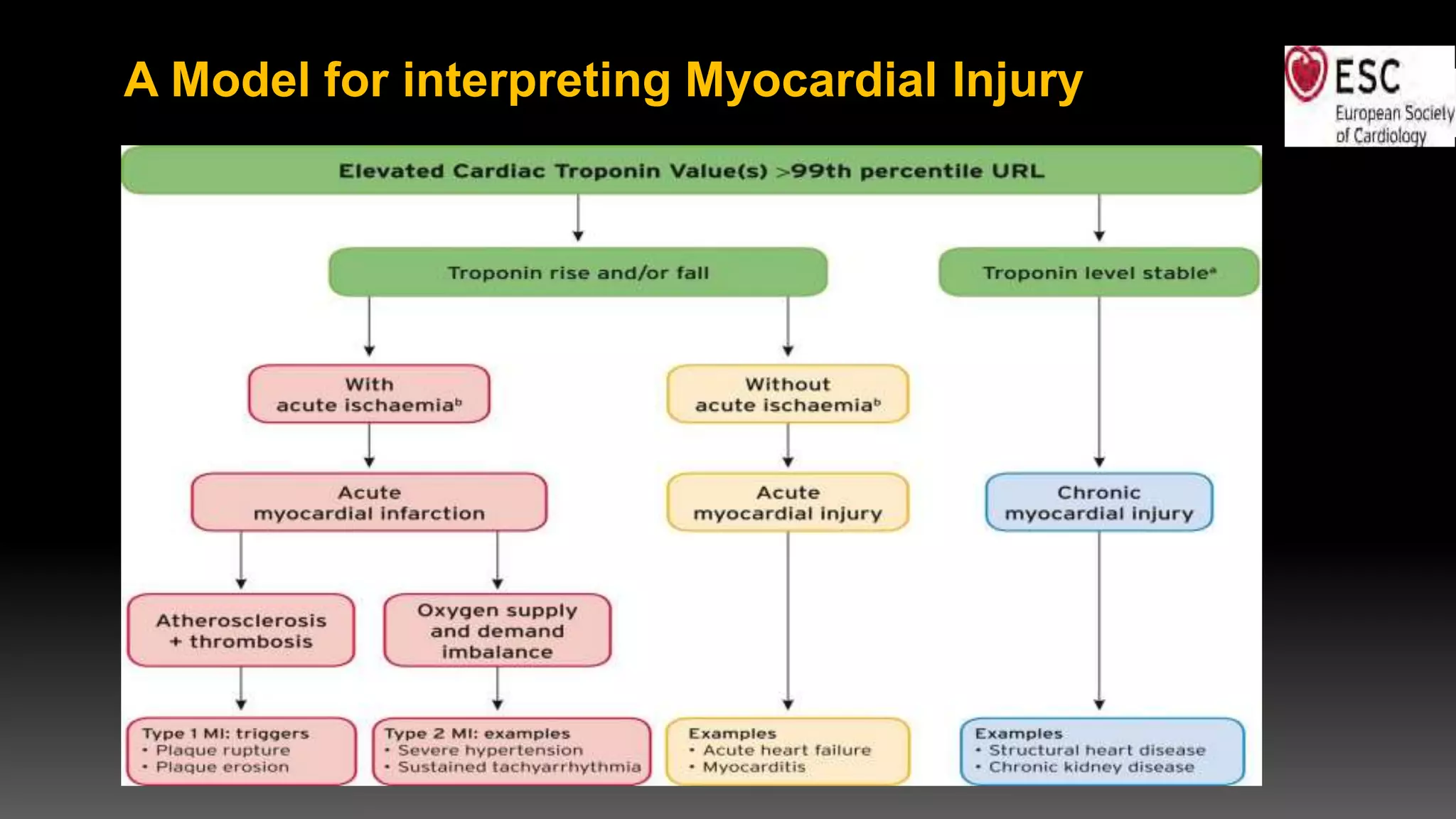 Universal Definition of Myocardial Infarct | PPTX