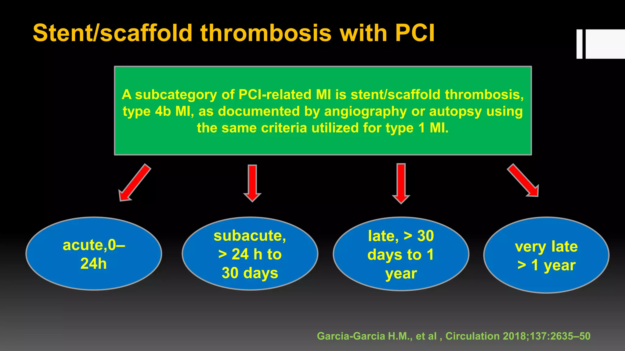Universal Definition of Myocardial Infarct | PPTX