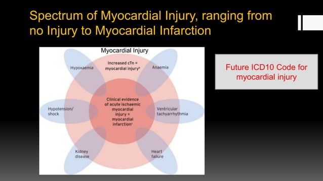 Universal Definition of Myocardial Infarct | PPTX