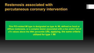 Universal Definition of Myocardial Infarct | PPTX