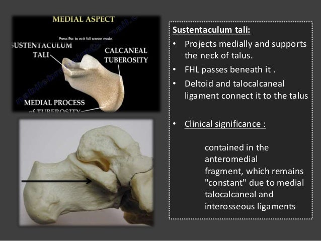 Calcaneal fractures