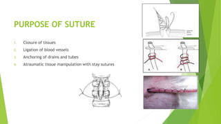 Suture material and suture patterns.pptx
