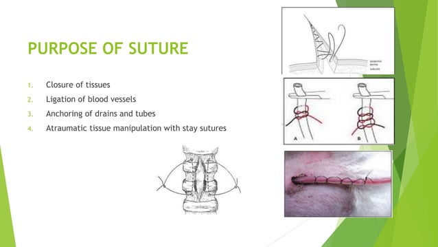 Suture material and suture patterns.pptx