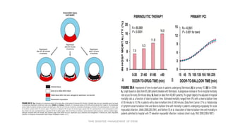 Time sensitive management of ST Elevation MI | PPT