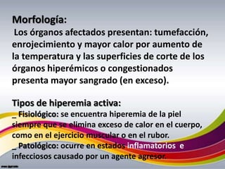 # 4 transtornos hemodinámicos | PPTX