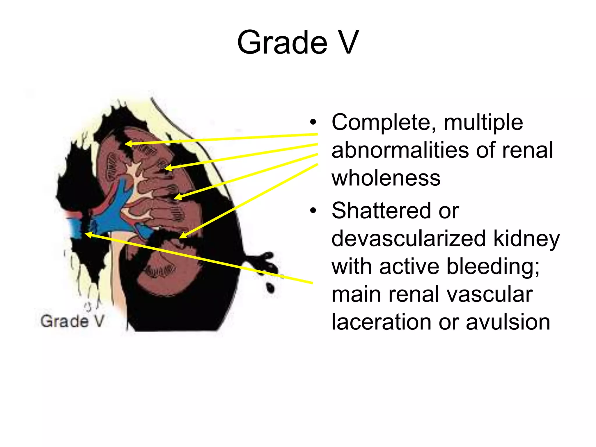 urology trauma (1).pptx