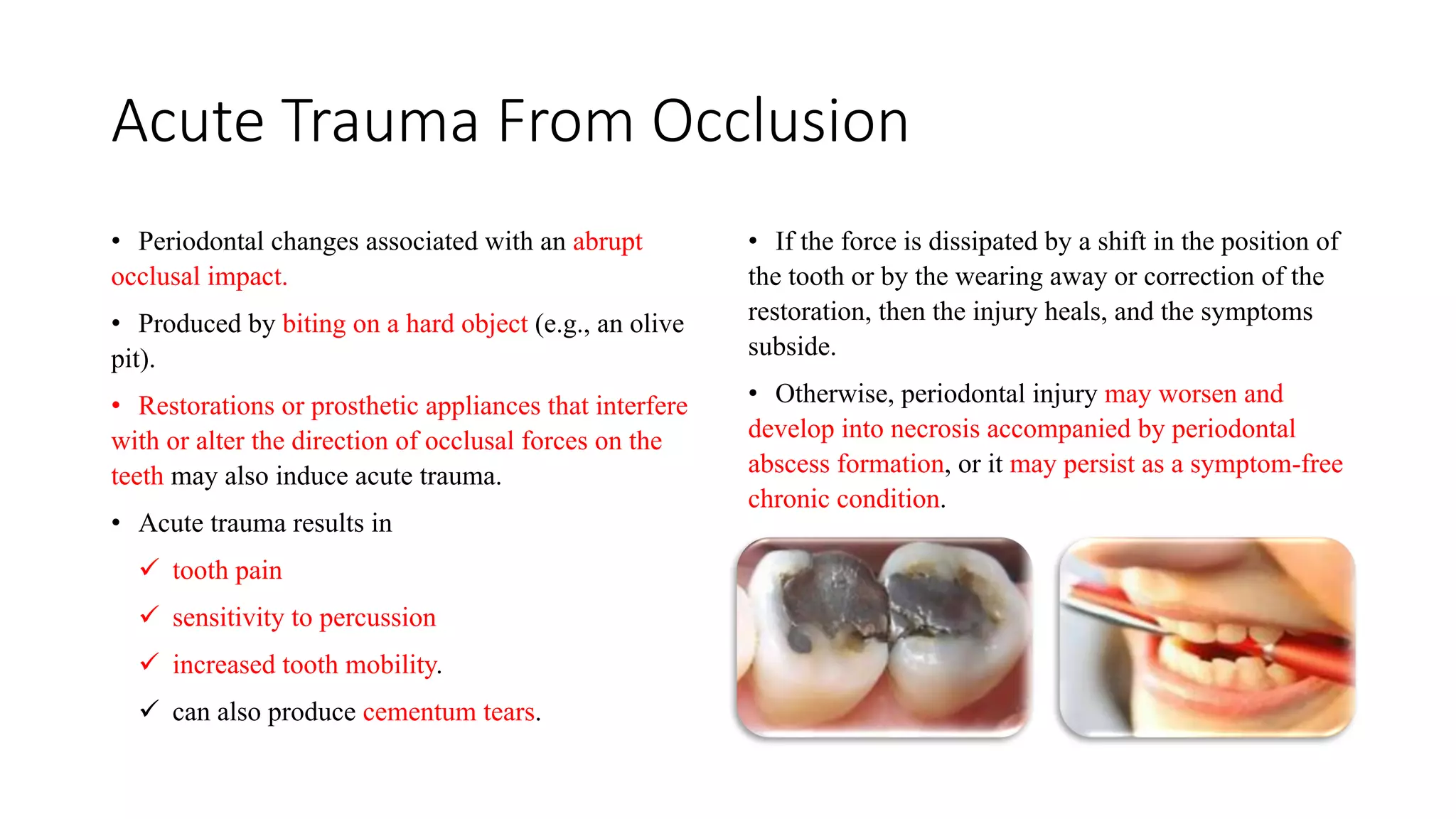 Trauma from Occlusion | PDF