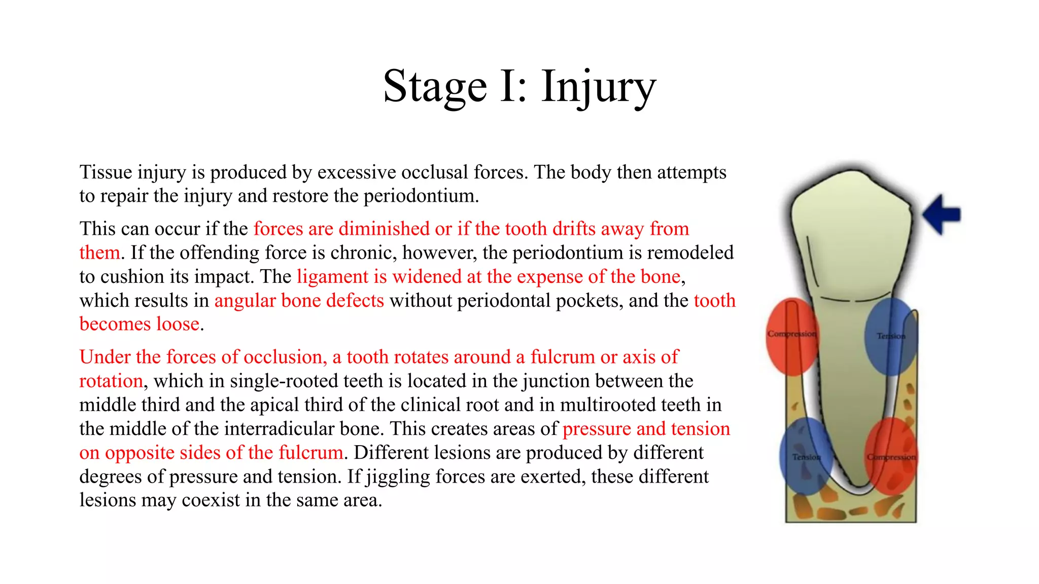 Trauma from Occlusion | PDF