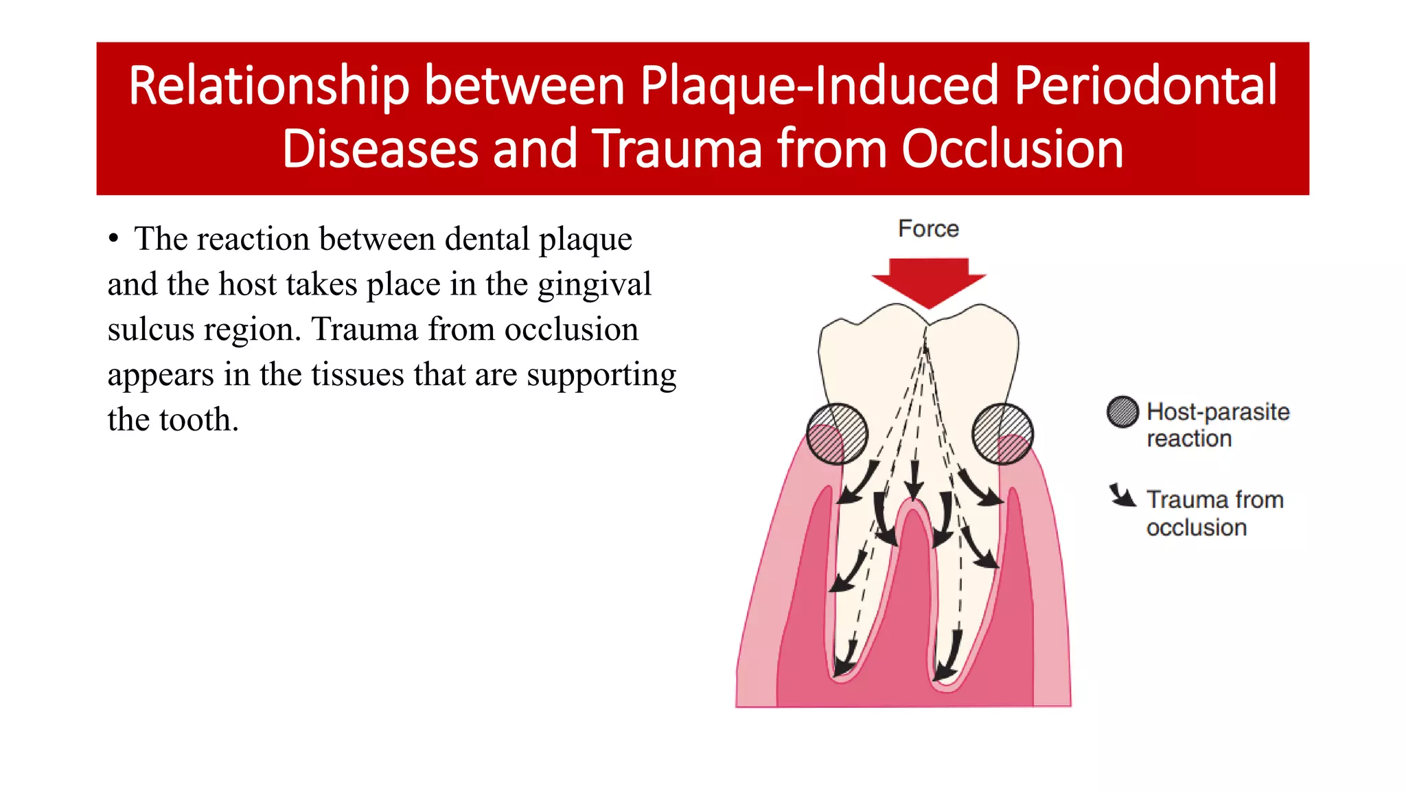 Trauma from Occlusion | PDF