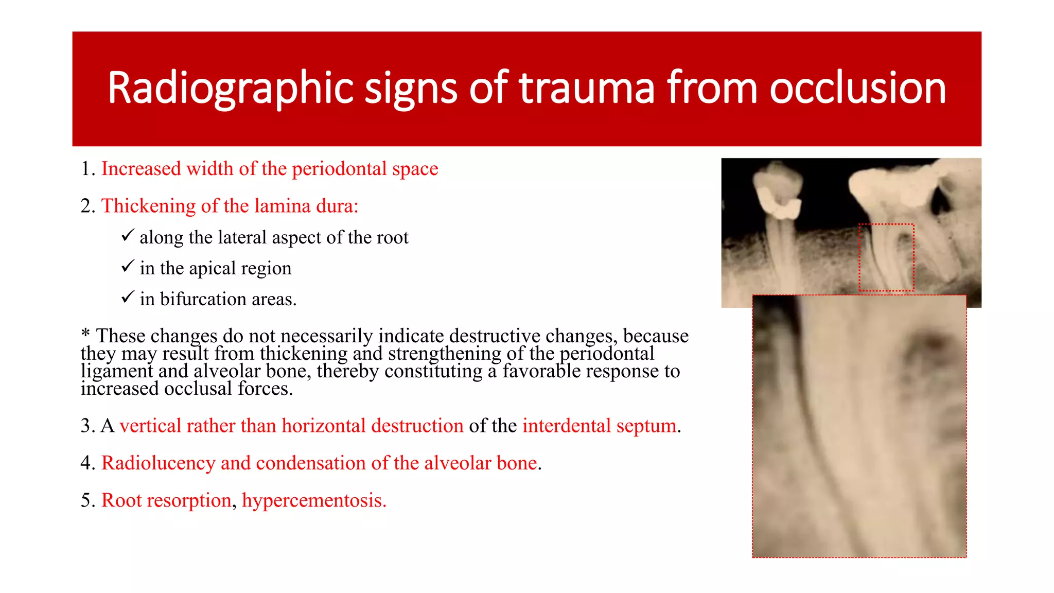Trauma from Occlusion | PDF